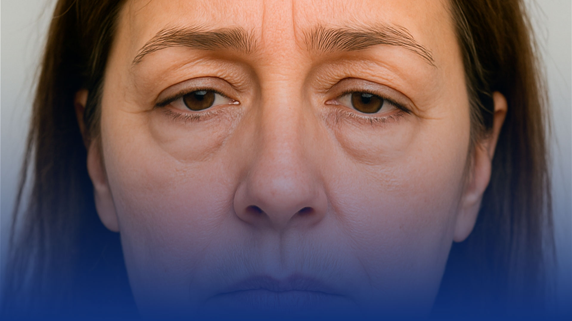 Pálpebras Inchadas e Caídas: Quando Procurar um Oftalmologista ...